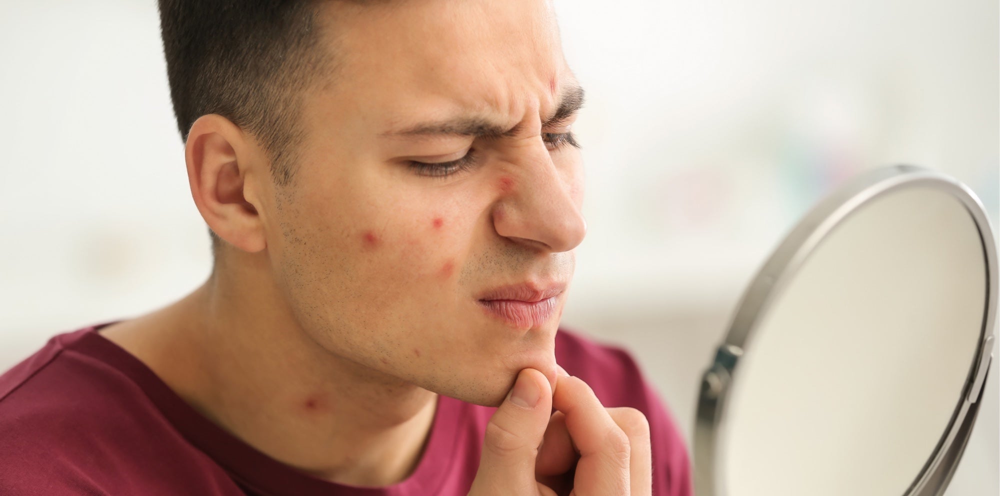 Popping Zits Bad